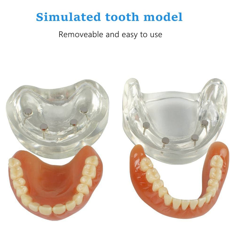 Teeth Demonstration Model Adult Standard with Removable Teeth for ...