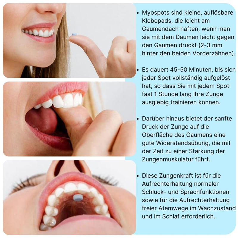 Myospots - Effective training for the tongue rest position in differen ...